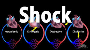 Shock (Phần 1) - UPTODATE 2020 - Tài Liệu Y Khoa Miễn Phí