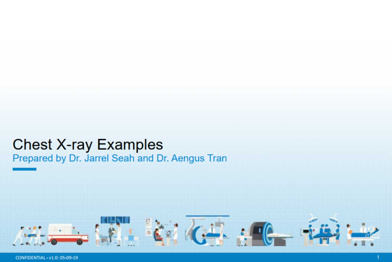 [PDF] CHEST X-RAY EXAMPLES