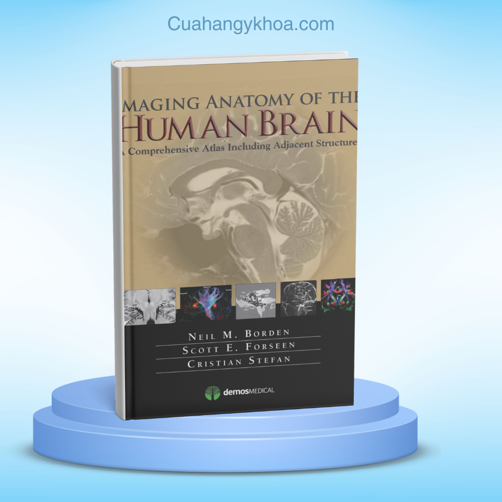 Imaging Anatomy of the Human Brain A Comprehensive Atlas Including ...